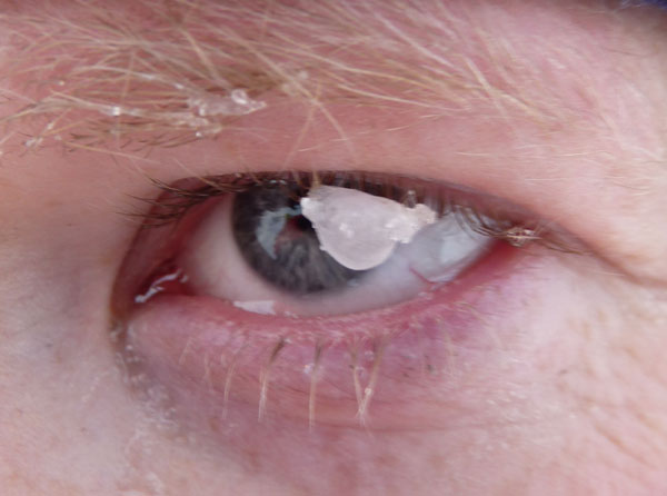 Ice in your eye .co .uk | Sand In Your Eye
